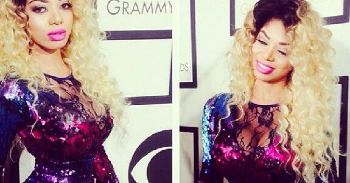 Dencia Before And After