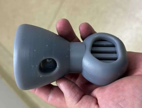 Pioneering procedure | UP doctors yelping with joy after successful ...